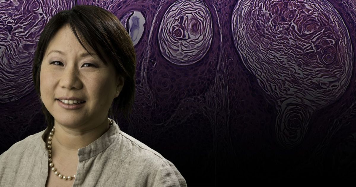 Sol-Gel To Tackle Gorlin Syndrome In Pact With BridgeBio’s PellePharm ...